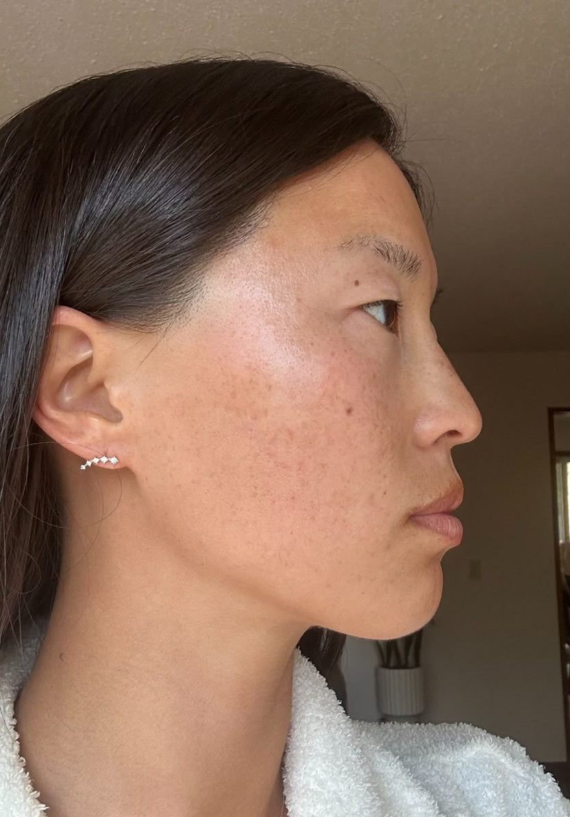 Higgy – Higgy Skin